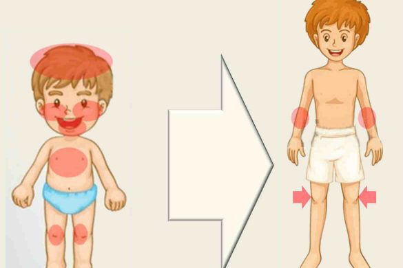 Quistes de milium: esas bolitas blancas en la cara | Doctora Lorea ...