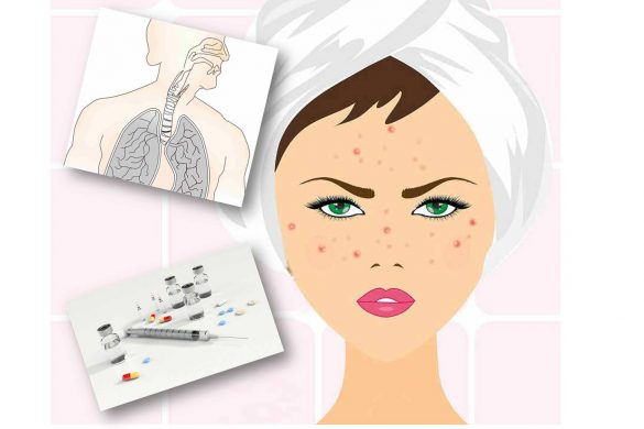 Quistes de milium: bolitas blancas en la cara - Dra. LOREA BAGAZGOITIA