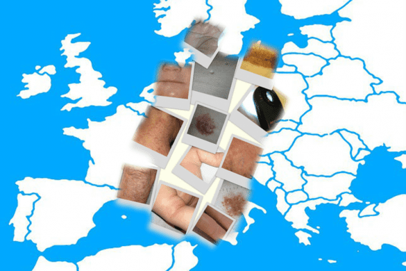 Ampollitas que pican en manos y pies: dishidrosis o ponfólix