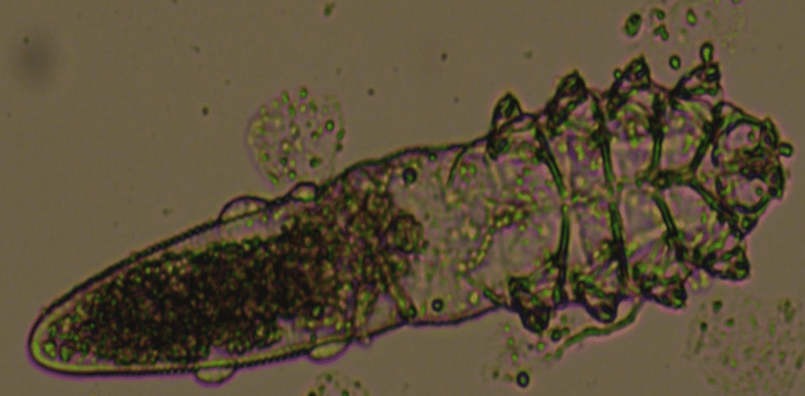 Demodex y rosácea : ¿causa o consecuencia? - Dra. LOREA BAGAZGOITIA