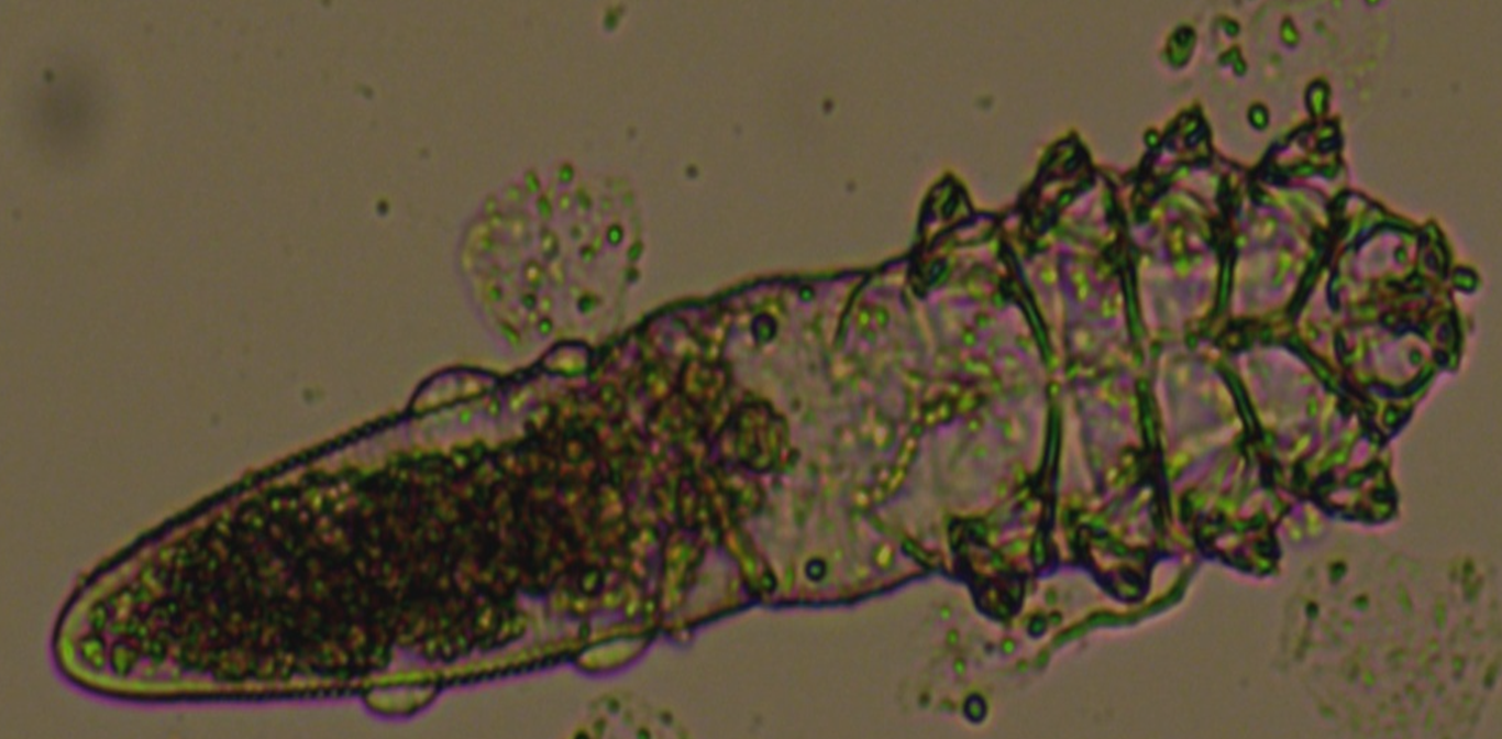 Demodex y rosácea : ¿causa o consecuencia? - Dra. LOREA BAGAZGOITIA