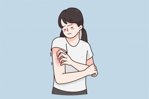 Ampollitas que pican en manos y pies: dishidrosis o ponfólix