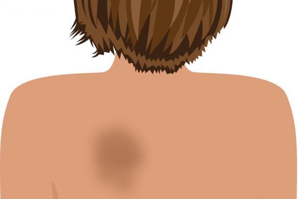 Doctora Lorea Bagazgoitia Dermatología